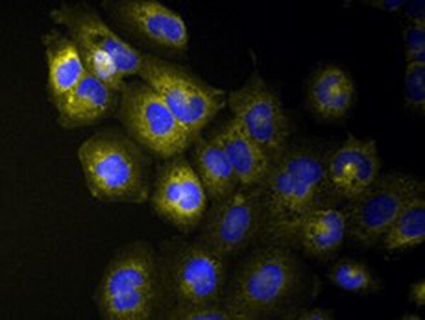 UM-SCC-105 Human Squamous Carcinoma Cell Line | SCC189